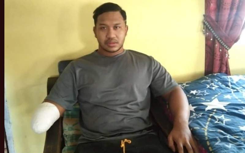 Putus Separuh tangan akibat terkena Mesin di Kilang - SAHIH